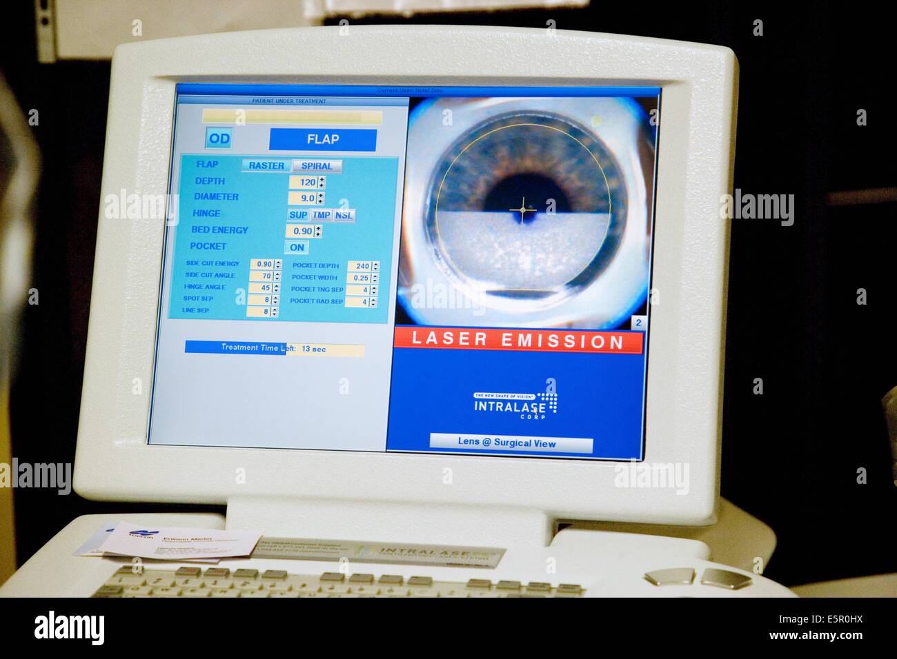 LASIK (Laser Assisted Intrastromal Keratomileusis). This surgery ...