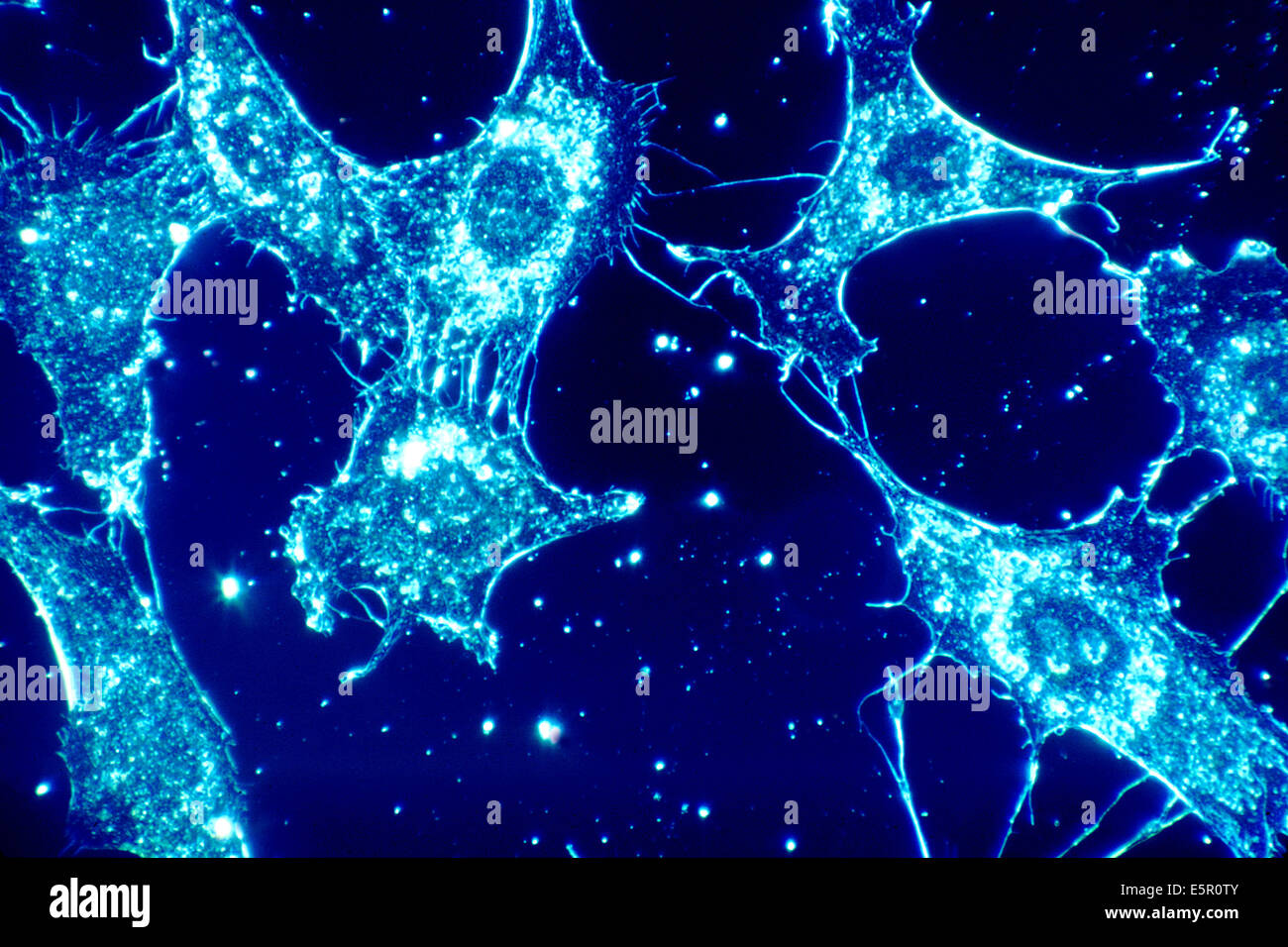 Connective tissue micrograph hi-res stock photography and images - Alamy