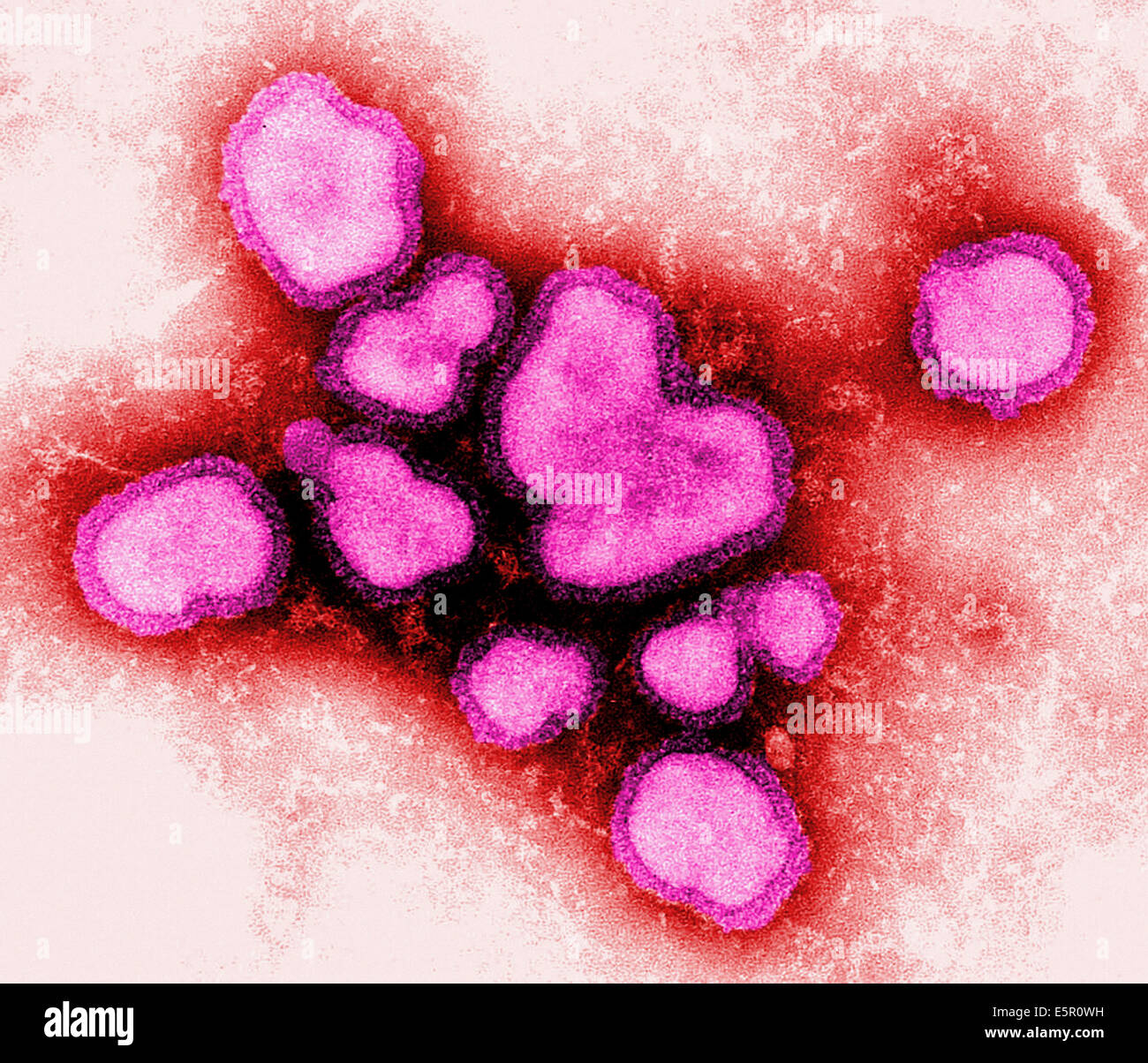 Influenza A virus , Transmission Electron Micrograph (TEM Stock Photo ... Influenza A virus , Transmission Electron Micrograph (TEM Stock Photo ...
