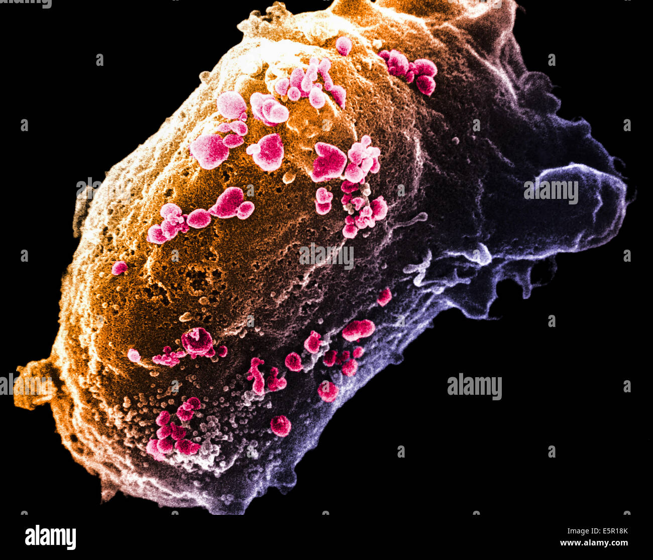 Electron microscopy human cell hi-res stock photography and images - Alamy