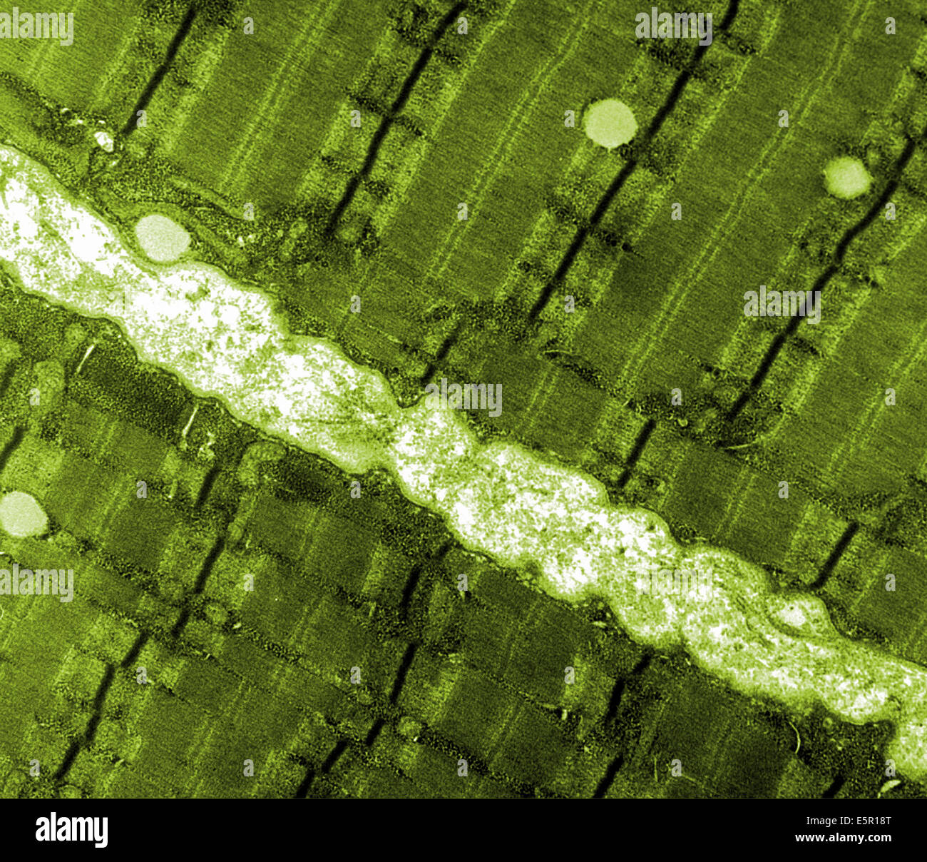 Skeletal muscle cells High Resolution Stock Photography and Images - Alamy