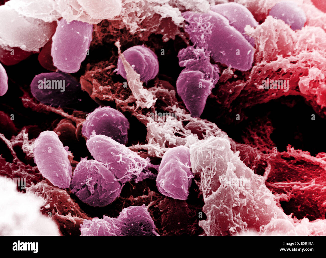 Bubonic plague hi-res stock photography and images - Alamy