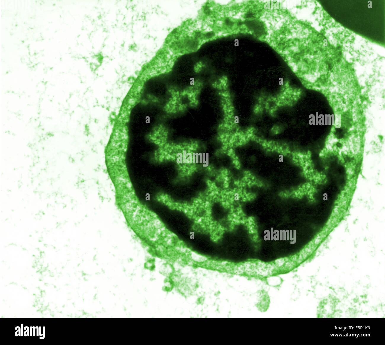 Transmission electron microscopy cells hi-res stock photography and ...