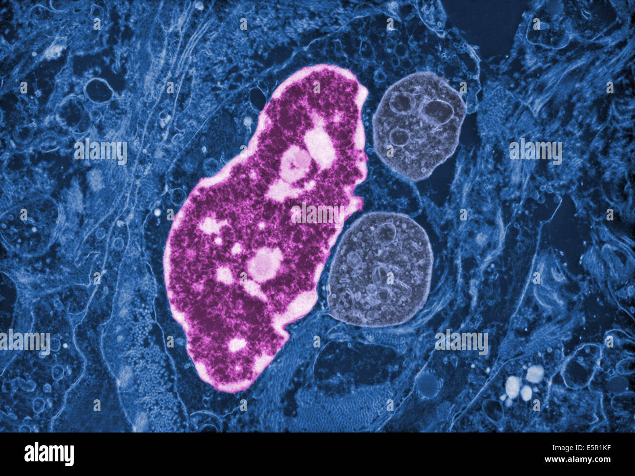 Transmission electron microscopy cells hi-res stock photography and ...