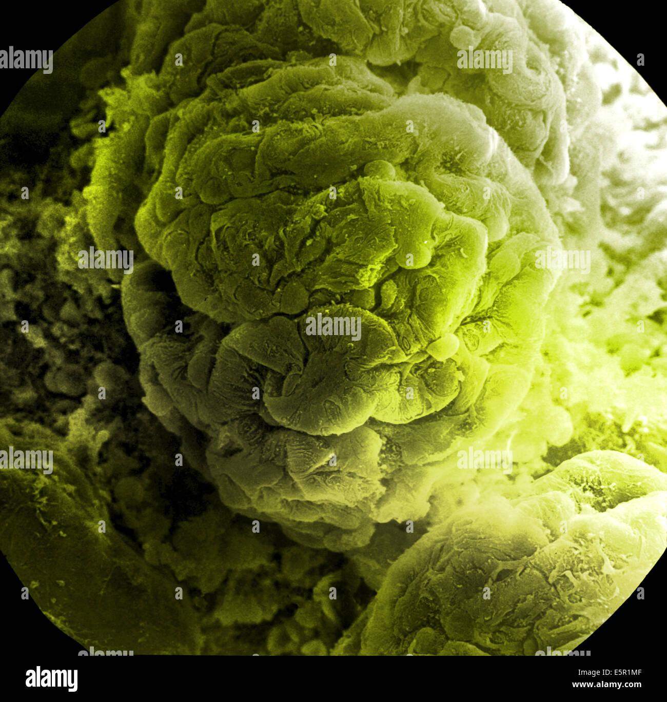 Podocytes glomeruli High Resolution Stock Photography and Images - Alamy