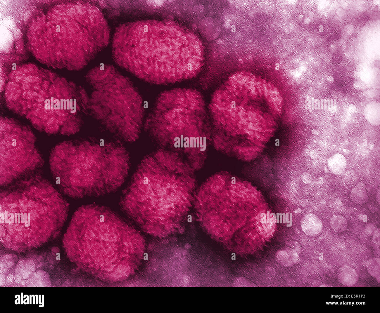 Smallpox hi-res stock photography and images - Alamy