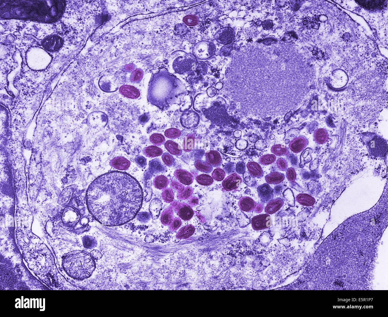 Transmission Electron Micrograph (TEM) of a cell containing variola ...