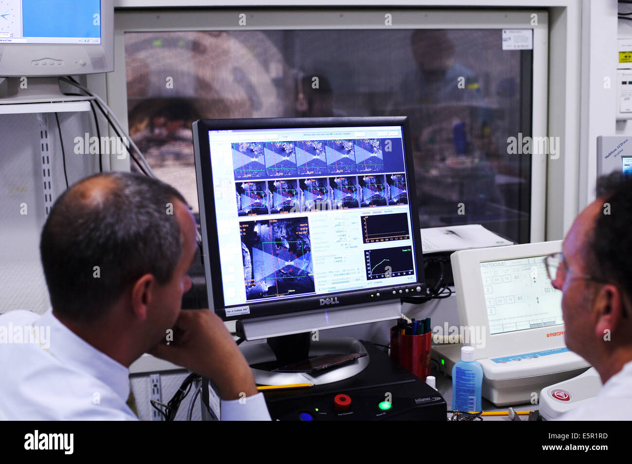 ExAblate® 2000 system with MR guided focused ultrasound uses a ...