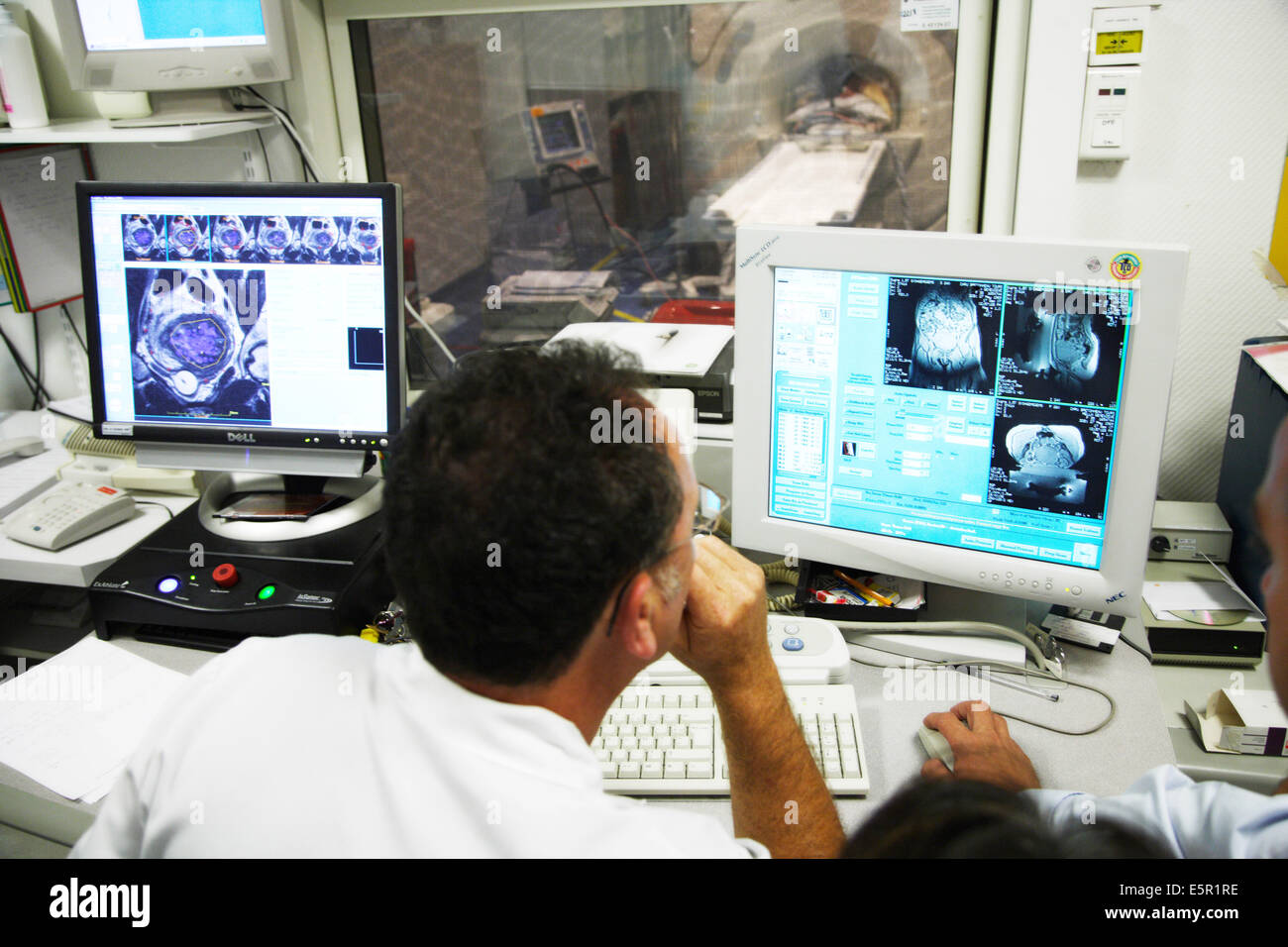 ExAblate® 2000 system with MR guided focused ultrasound uses a ...