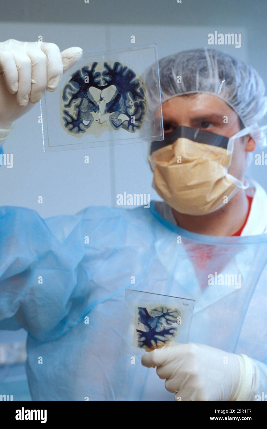 Morphological Pathology Laboratory, Prion diseases study. Brain ...