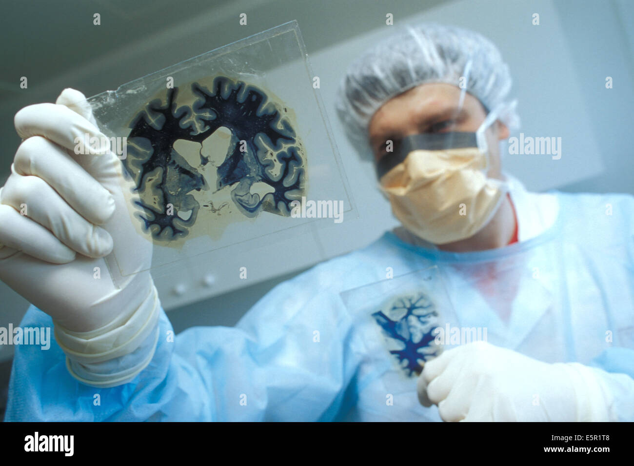 Morphological Pathology Laboratory, Prion diseases study. Brain ...