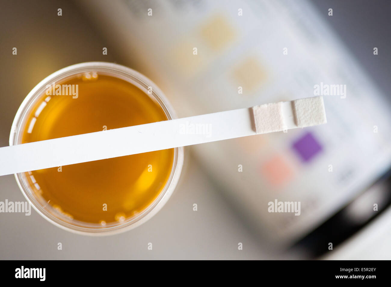 Uritest urine analysis home test, for urinary tract infection screening ...
