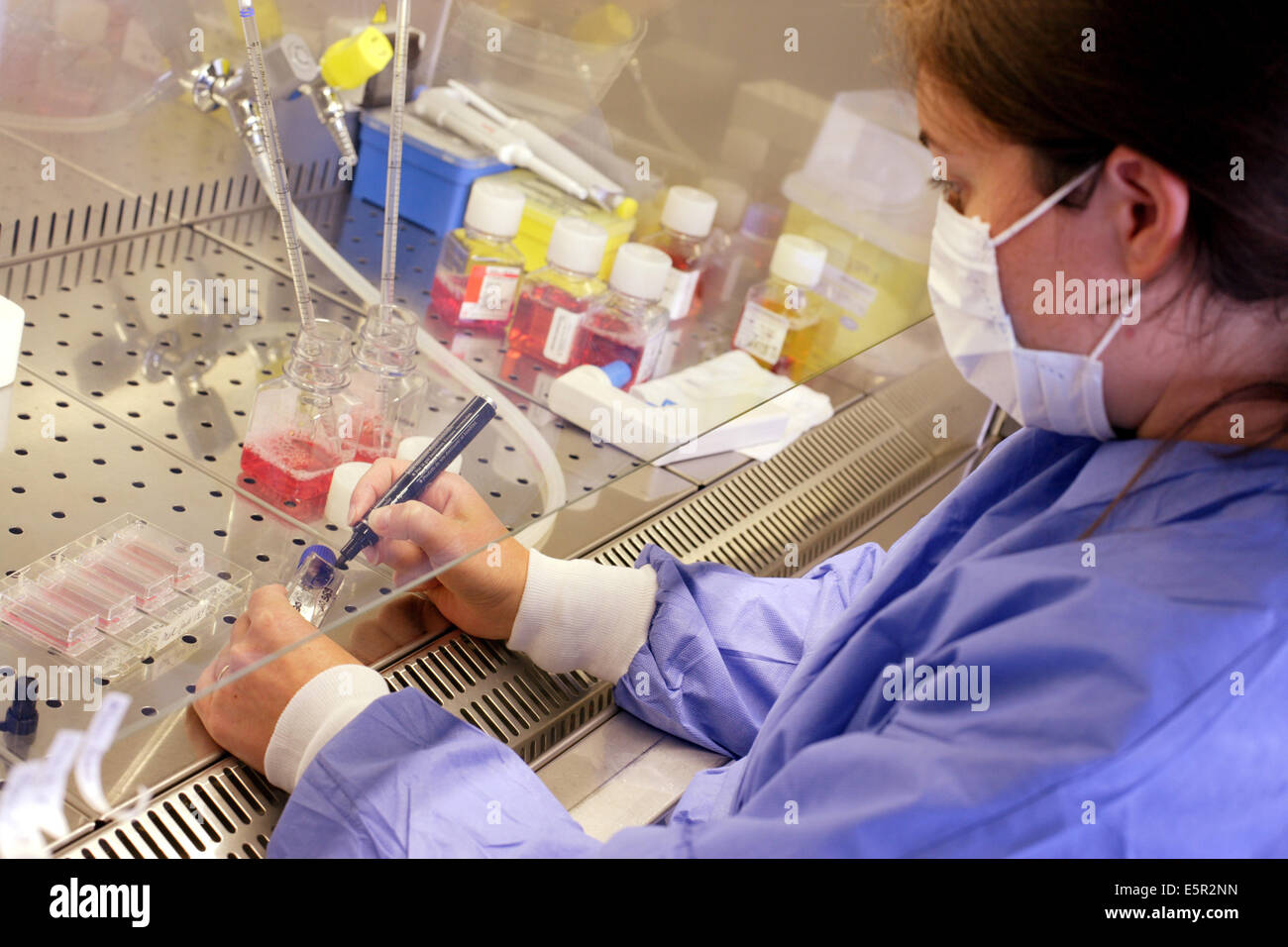 Antenatal diagnosis : cells of amniotic fluid are cultivated for ...