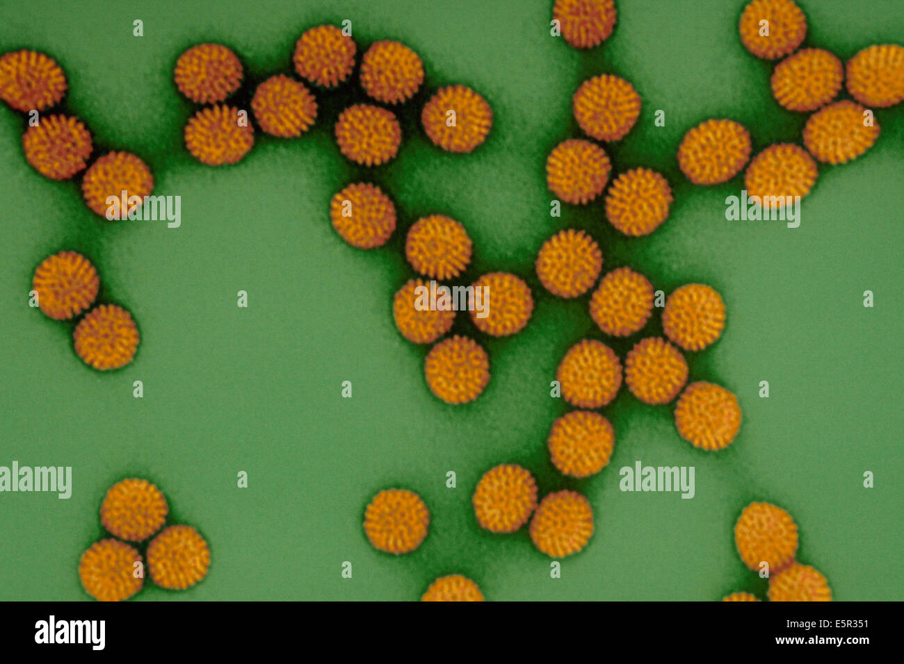 Color enhanced transmission electron micrograph (TEM) of Rotavirus, a ...