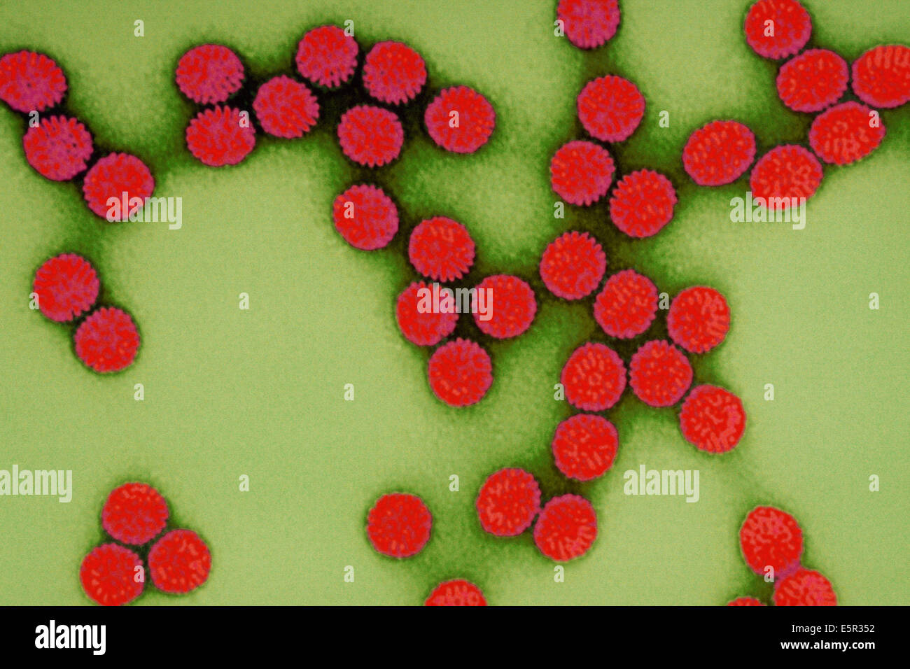 Color enhanced transmission electron micrograph (TEM) of Rotavirus, a ...