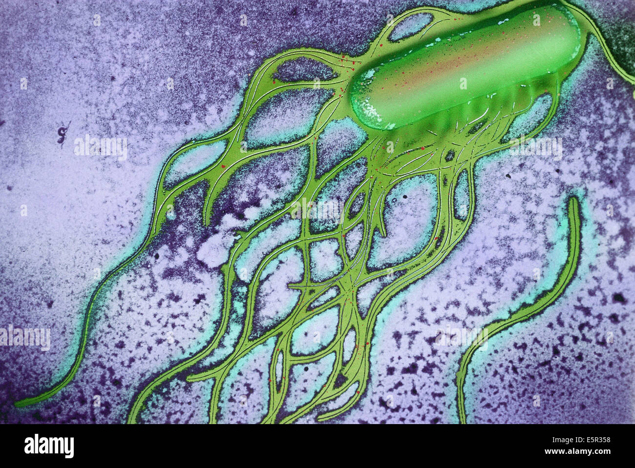 Transmission electron micrograph (TEM) of Salmonella sp, When ingested ...