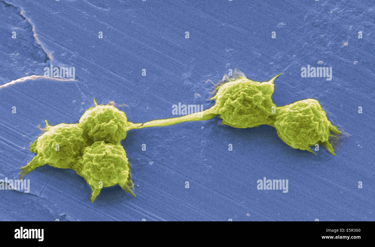 Color enhanced scanning electron micrograph of cysts of the protozoan ...