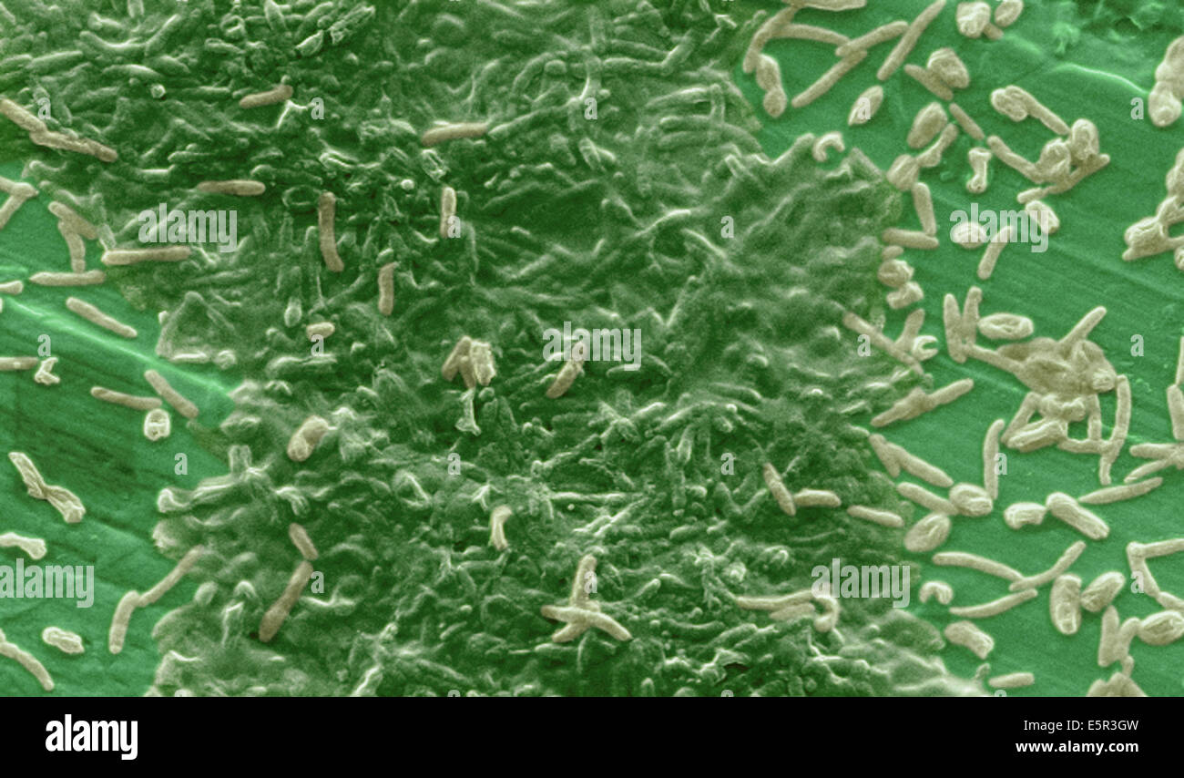 Color enhanced scanning electron micrograph (SEM) of a laboratory-grown ...