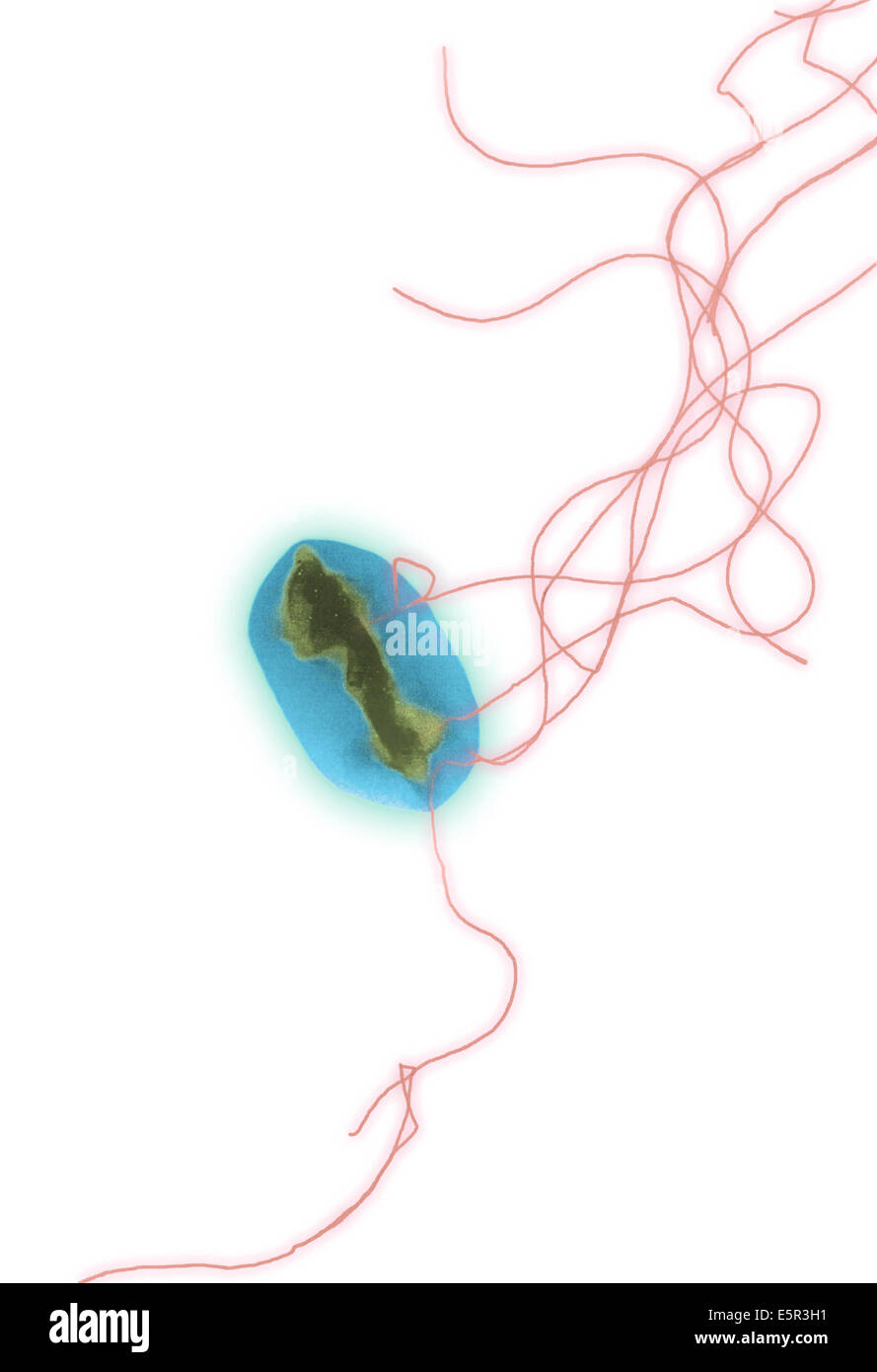 Color enhanced transmission electron micrograph (TEM) of Escherichia ...