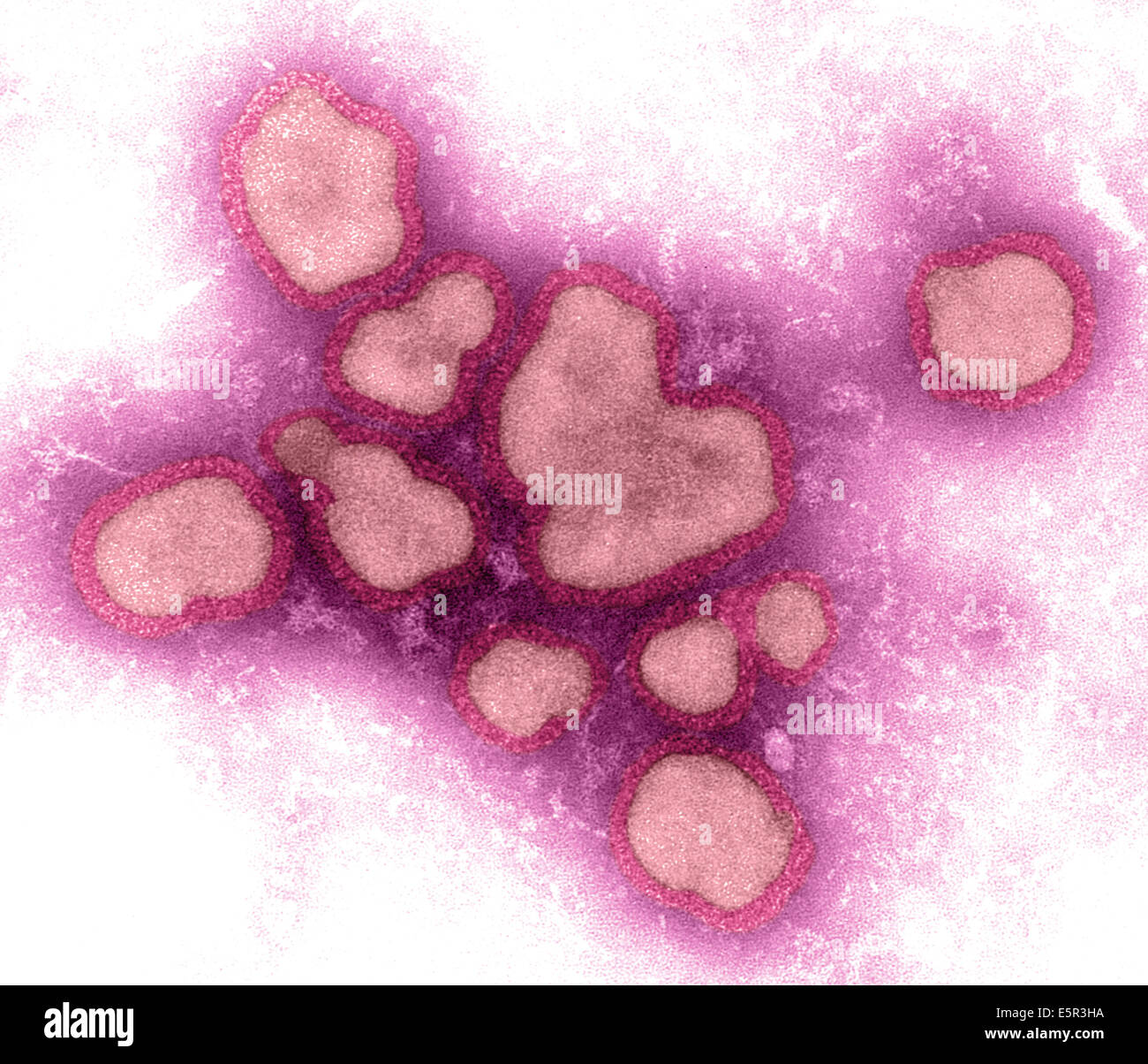 Influenza A virus causes flu , Transmission Electron Micrograph (TEM ...