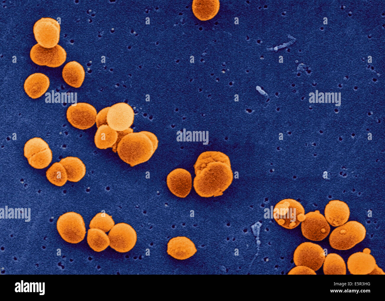 Color ehanced scanning electron micrograph (SEM) of Staphylococcus ...
