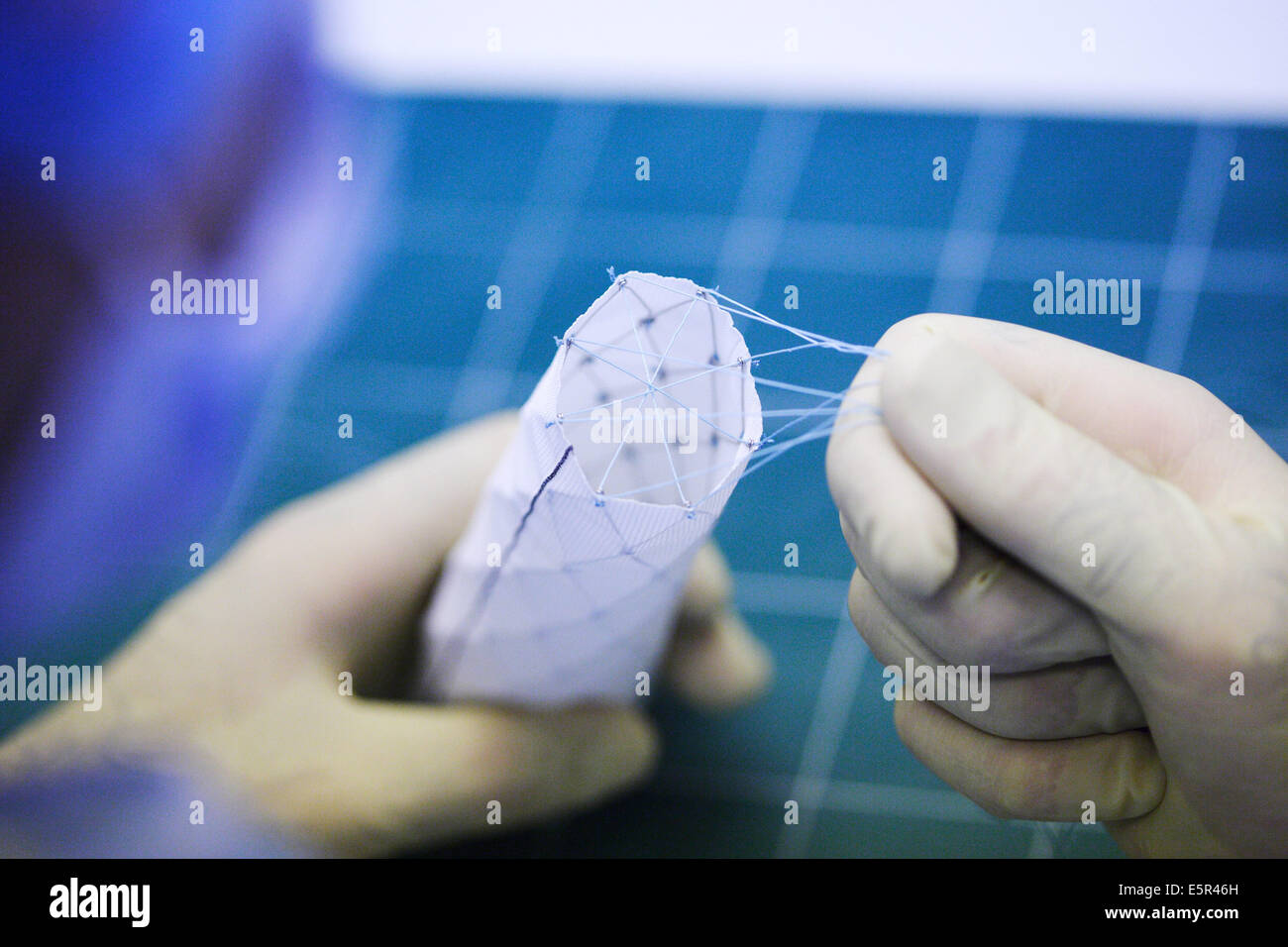 Surgery to treat aortic lesions with custom-made endovascular implants ...