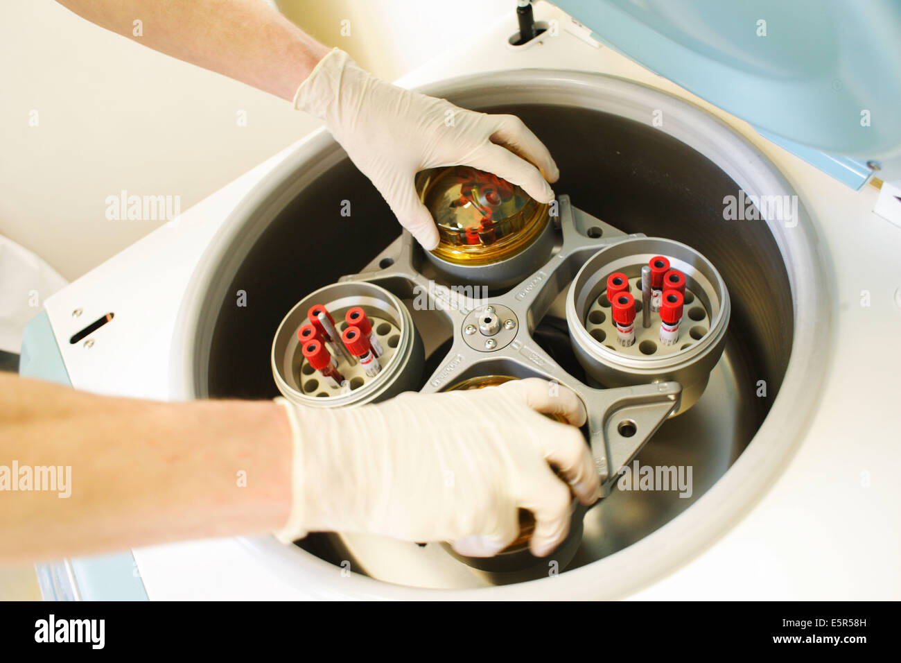 Blood fractionation from obese persons by centrifugation in order to ...