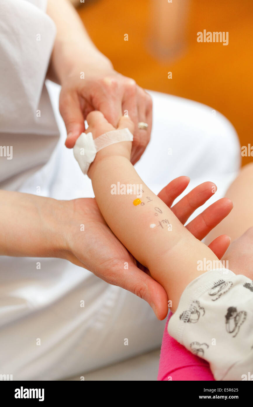 Child undergoing skin prick test for allergens screening, Limoges ...