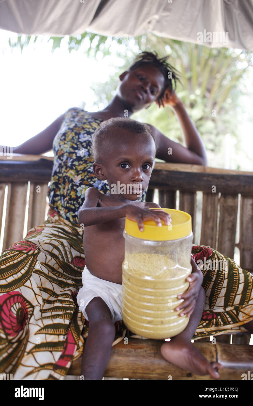 Marasmus hi-res stock photography and images - Alamy