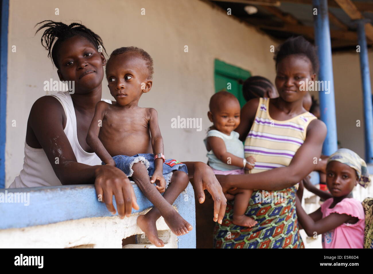 Marasmus hi-res stock photography and images - Alamy