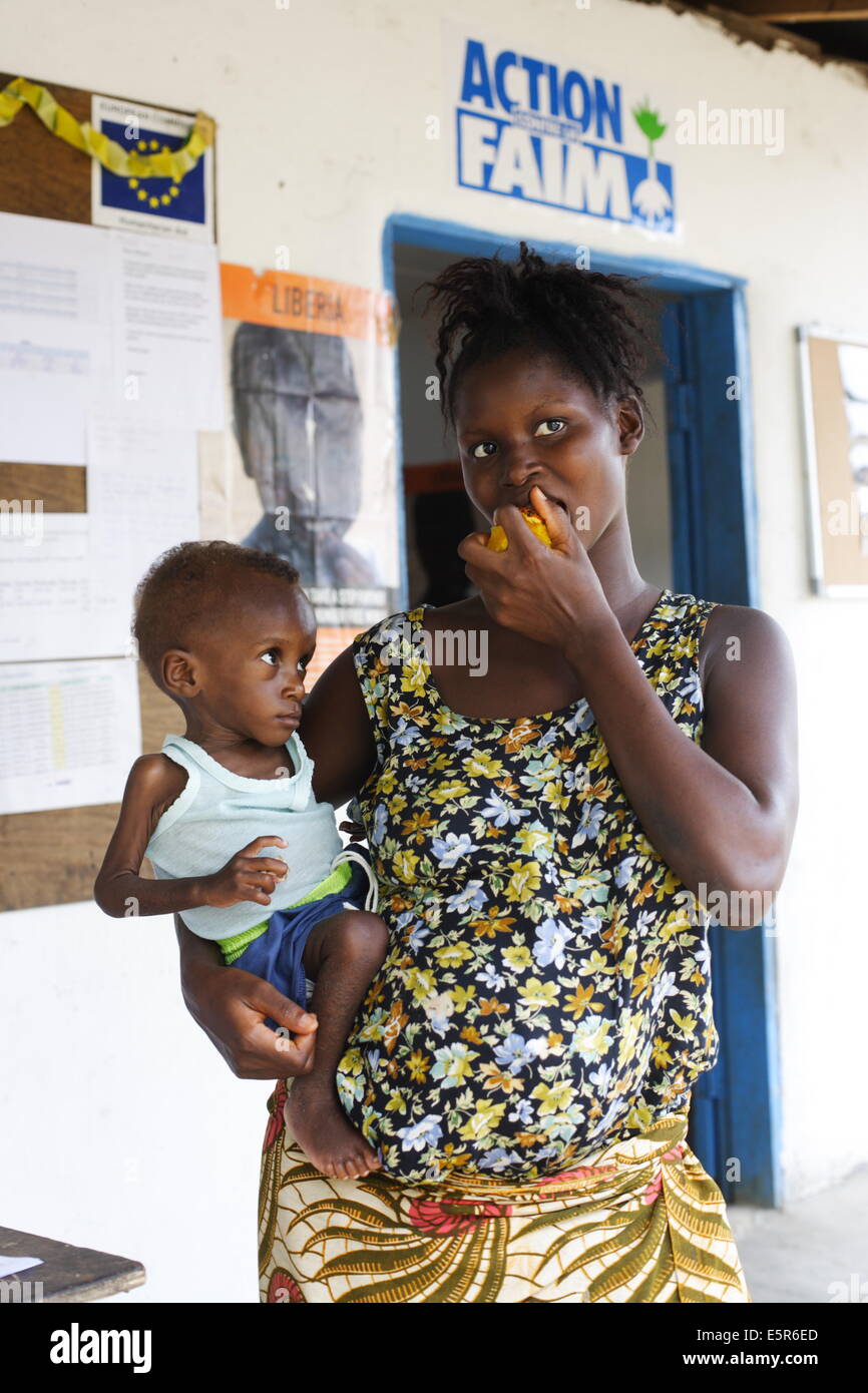 Mother and her 18 months old undernourished baby suffering from ...