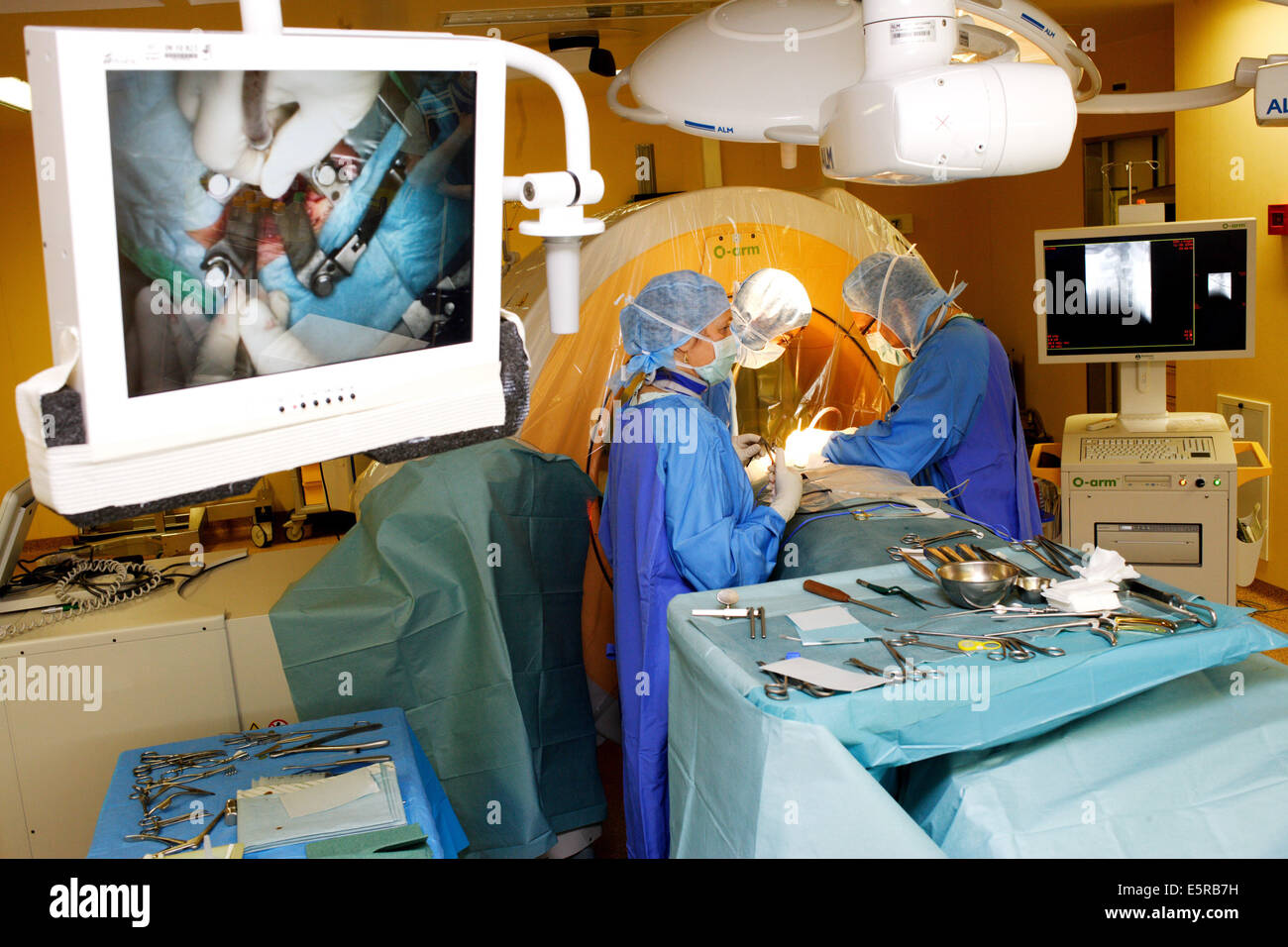 Prosthetic spinal disc hi-res stock photography and images - Alamy