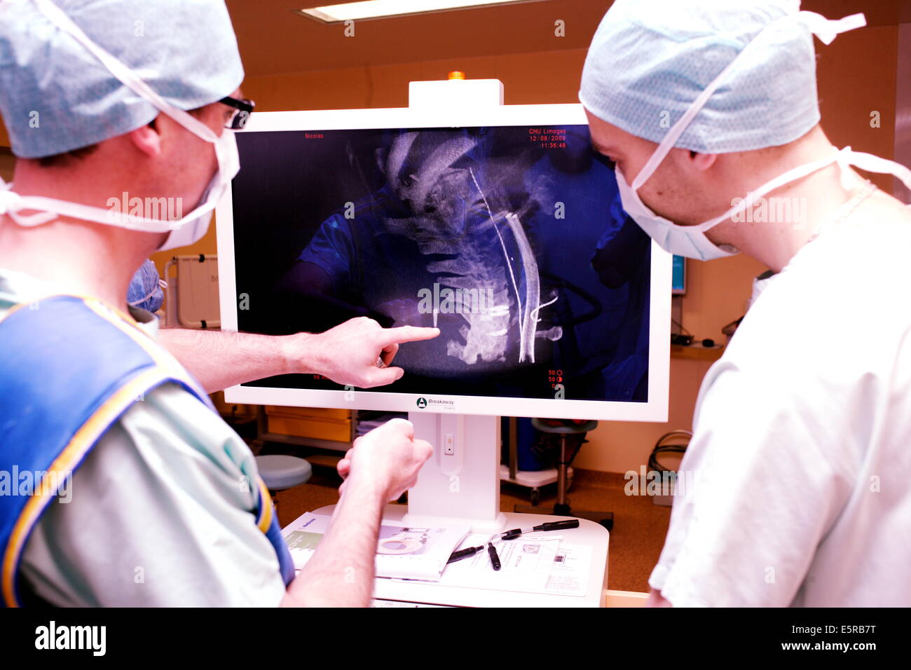 Intervertebral Disc Prosthesis