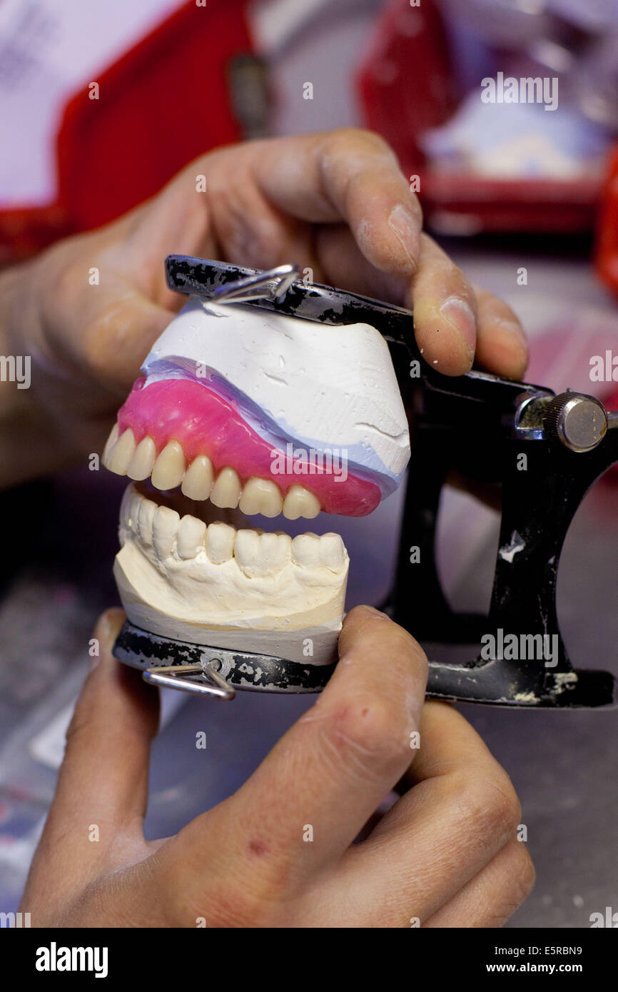 Fabrication of complete dentures Stock Photo - Alamy