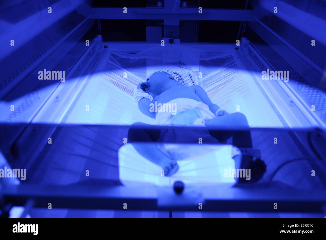 Baby with phototherapy hi-res stock photography and images - Alamy