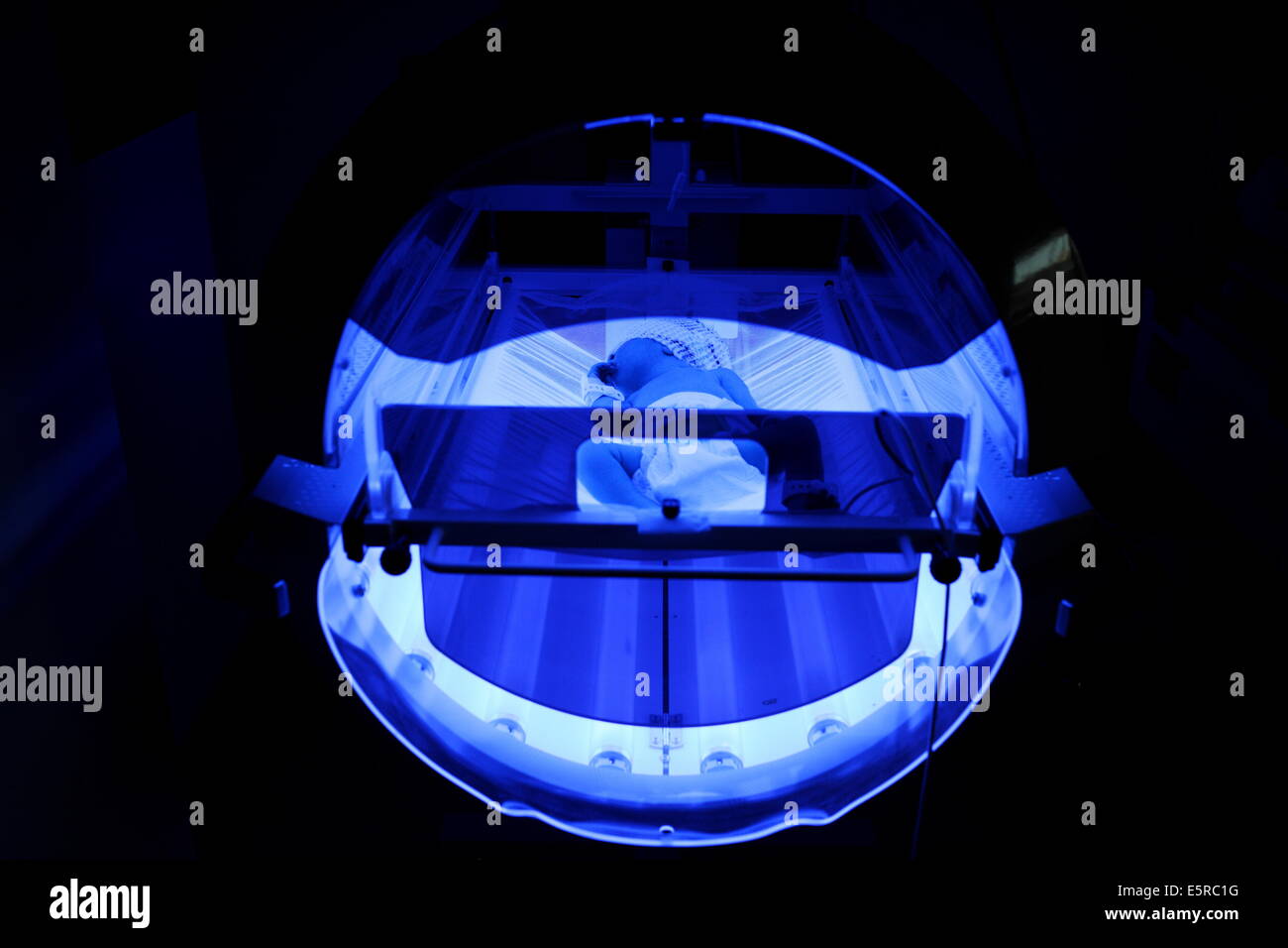 Newborn baby undergoing ultraviolet light treatment for jaundice Stock ...