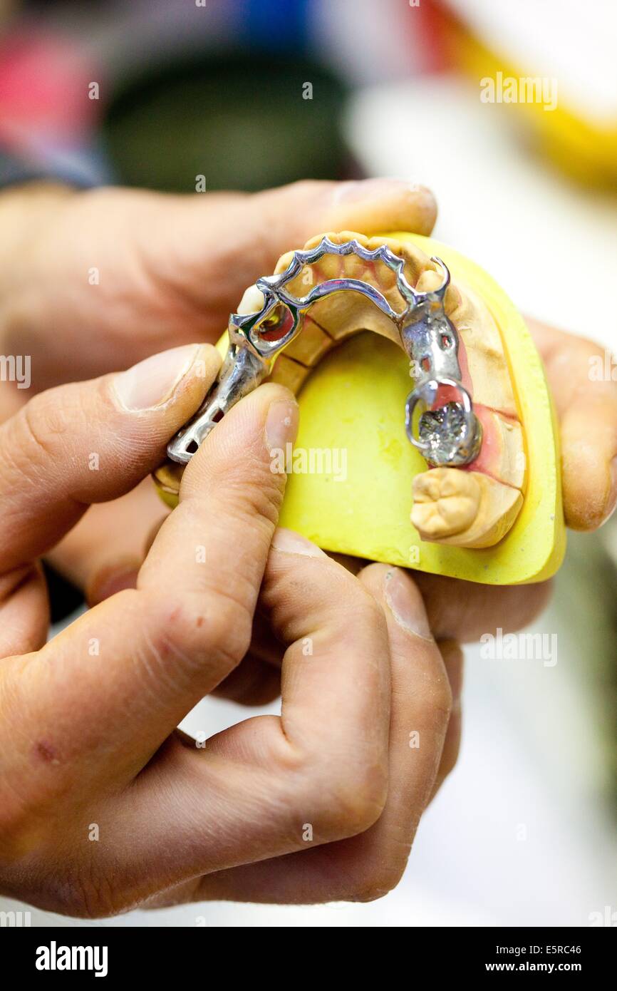 Fabrication of a denture-skeleton Stock Photo - Alamy