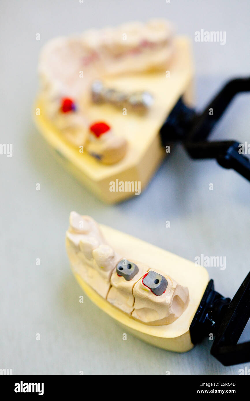 Inlay hi-res stock photography and images - Alamy