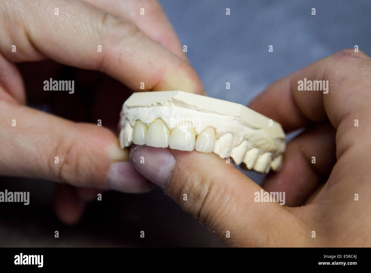 Fabrication of artificial ceramic crowns Stock Photo - Alamy