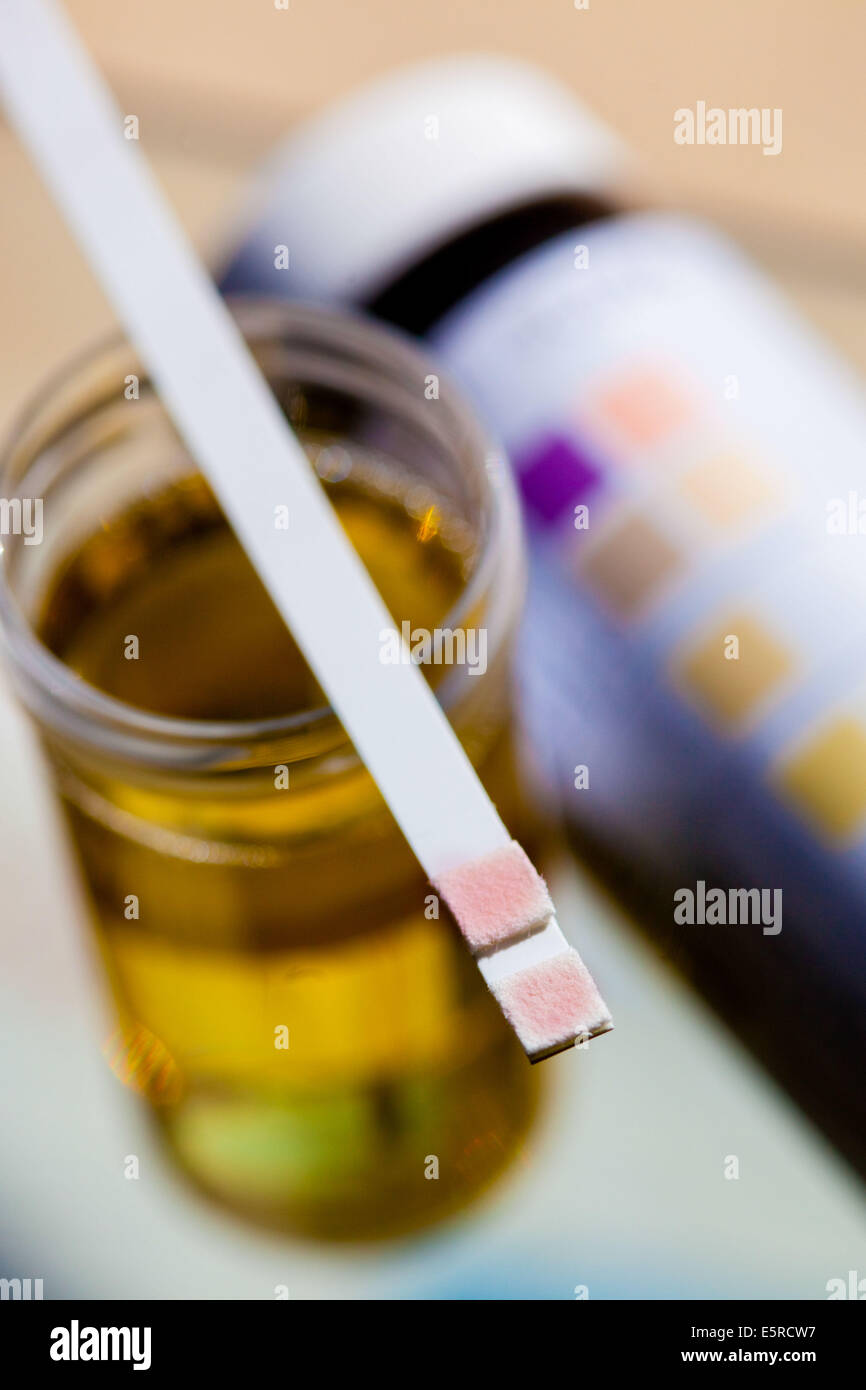 Uritest urine analysis home test, for urinary tract infection screening ...