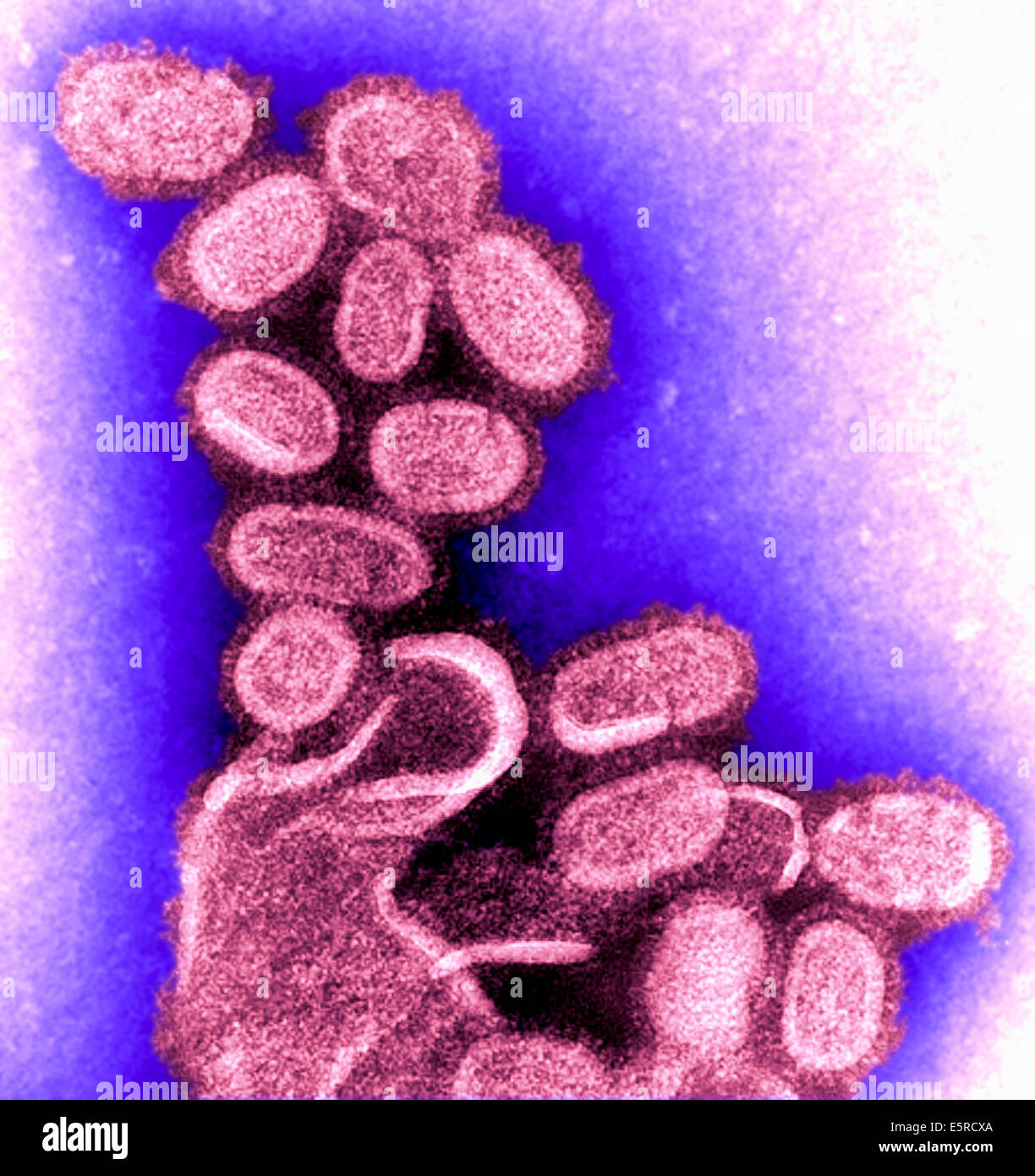 Transmission Electron Micrograph (TEM) of Spanish flu virus, this ...