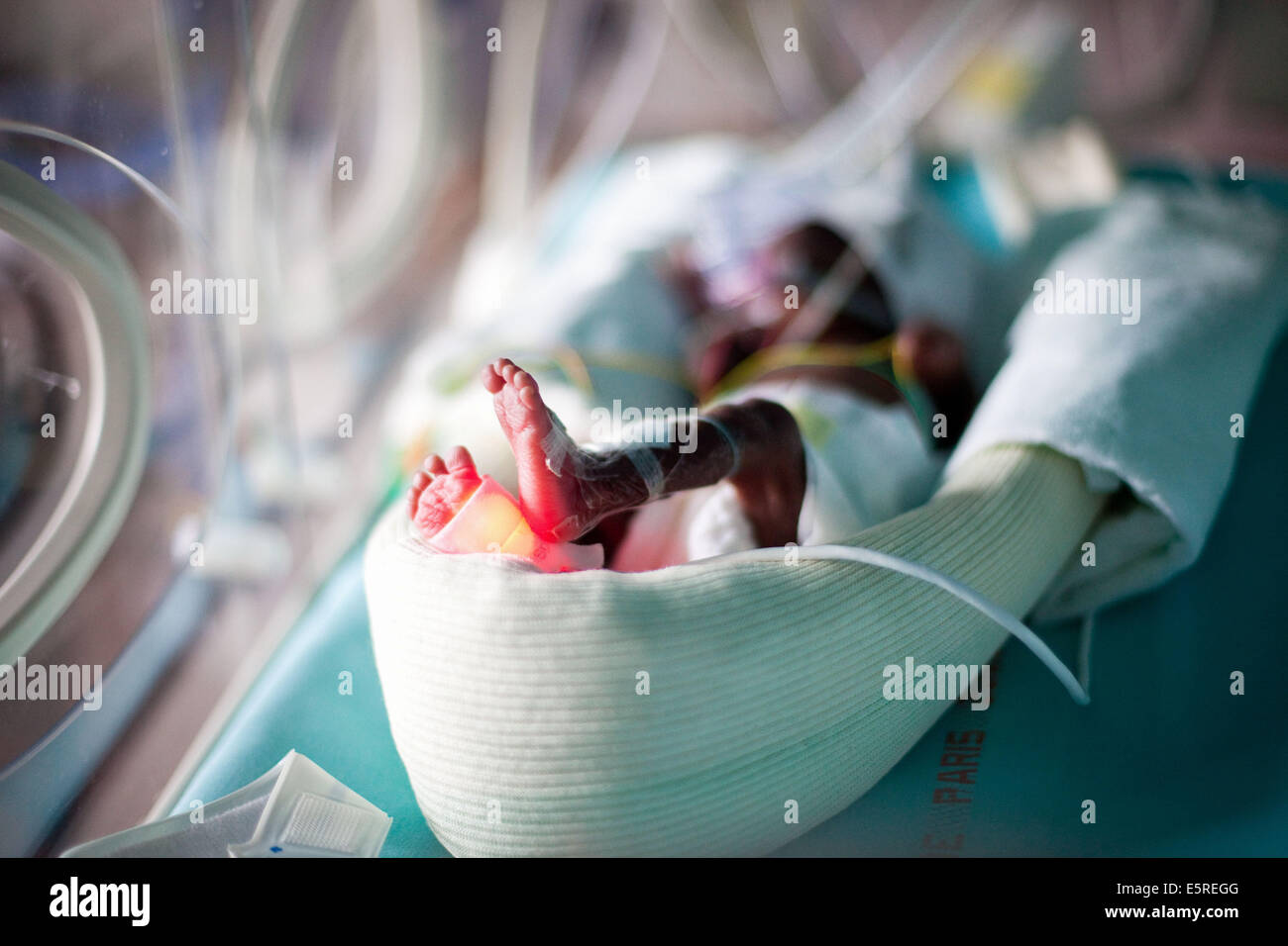 Premature infant oxygen hi-res stock photography and images - Alamy