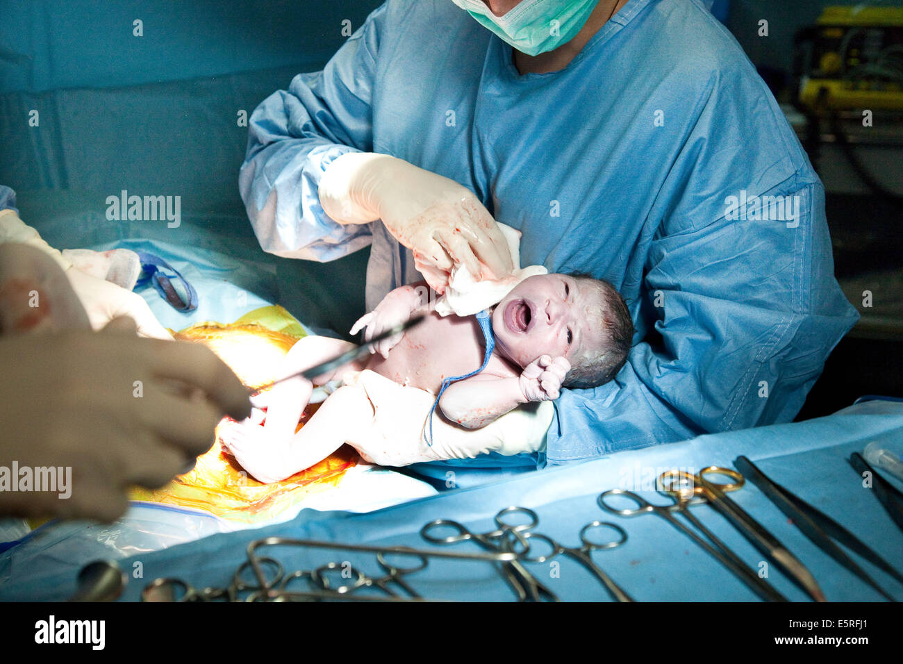 Caesarean section maternity department cochin hi-res stock photography ...