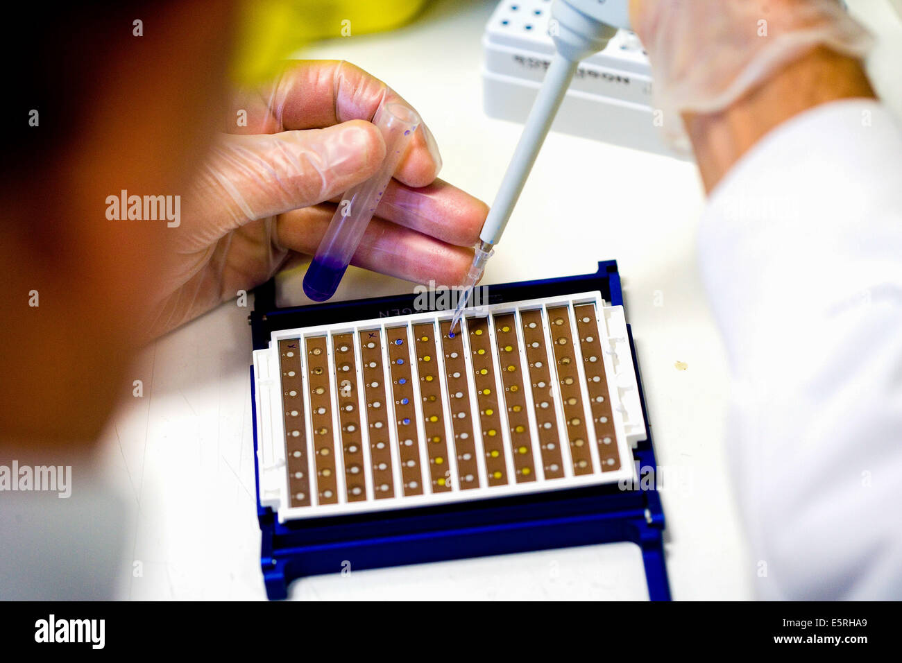 Proteomic analysis of genes of cancer, study of proteins of a cancer ...