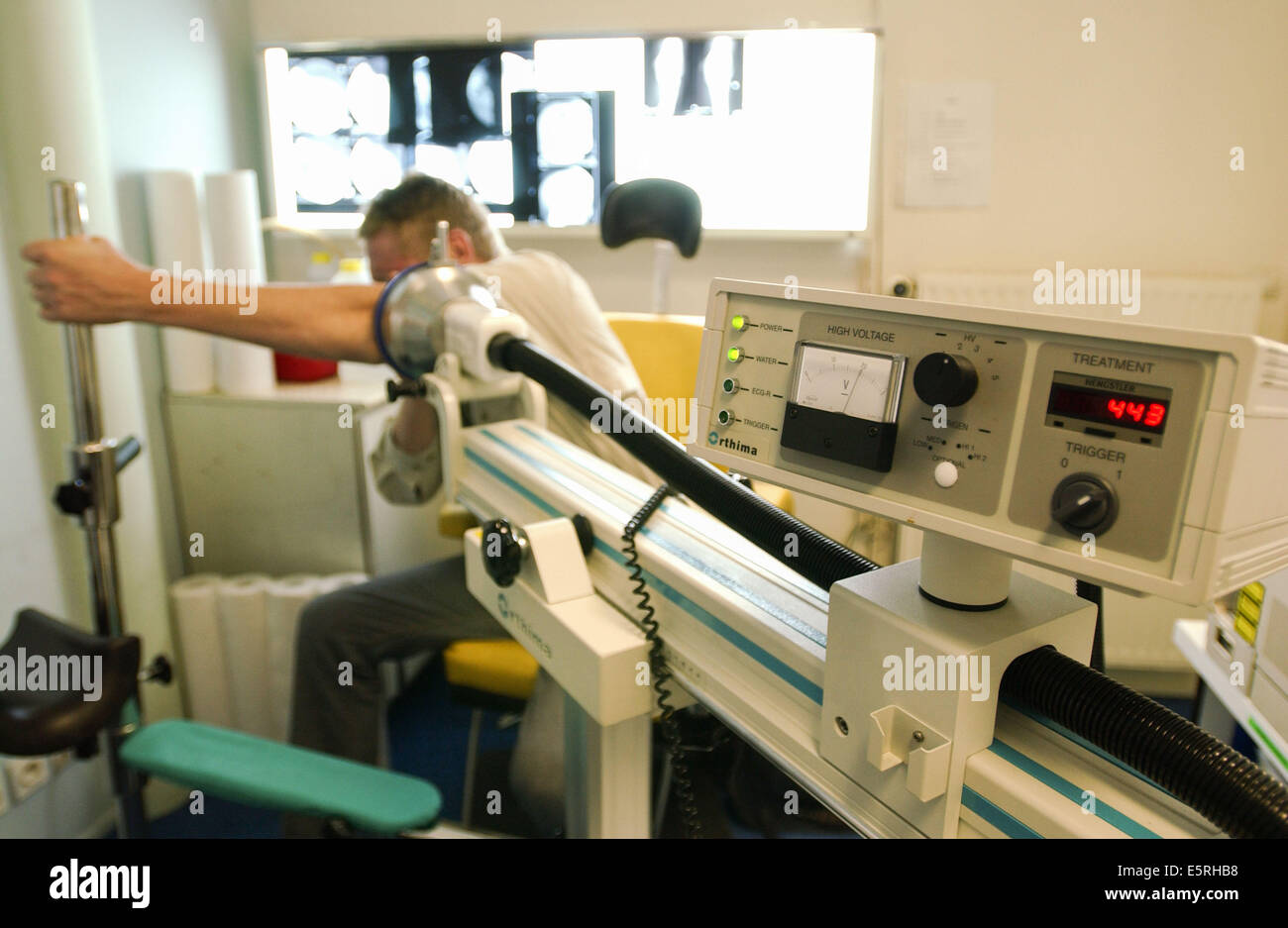 Radial shock waves, tendinitis treatment by shock waves Stock Photo - Alamy