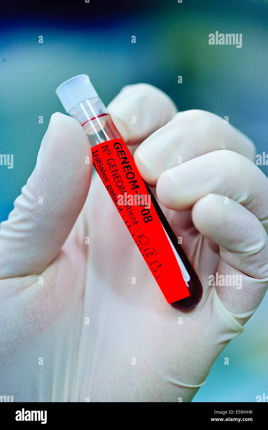 Blood samples used for oncognetic analysis, Human Molecular Oncology ...