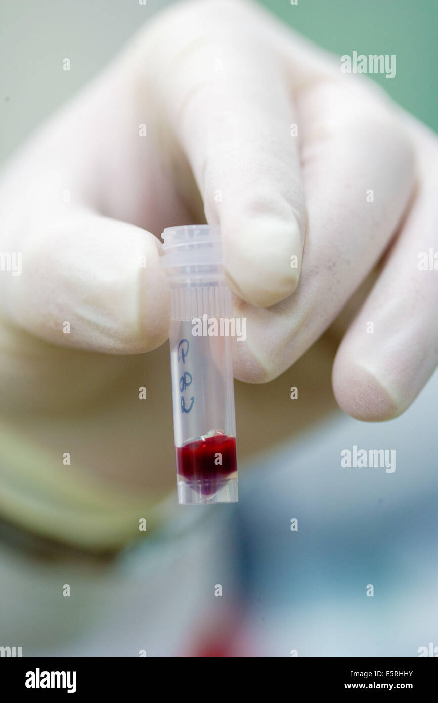 Blood samples used for oncognetic analysis, Human Molecular Oncology ...
