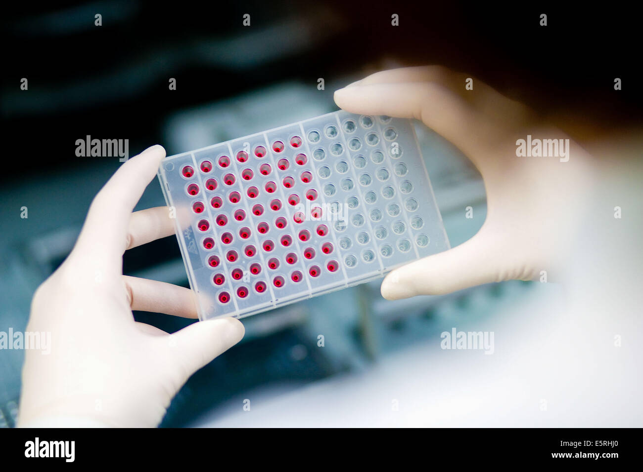 Cultures of cancer cells used for the study of new medicines, Human ...