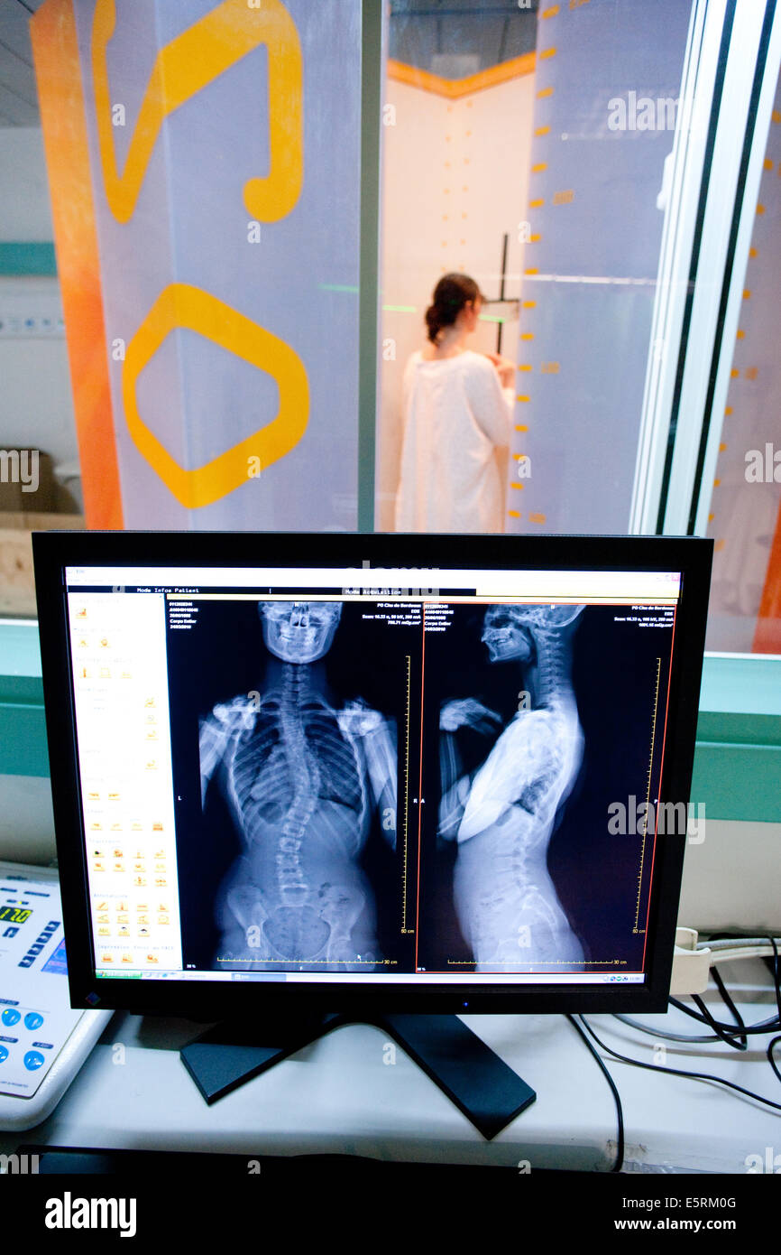 EOS biplanar X-ray scanner, this 2D and 3D digital X-ray imaging ...