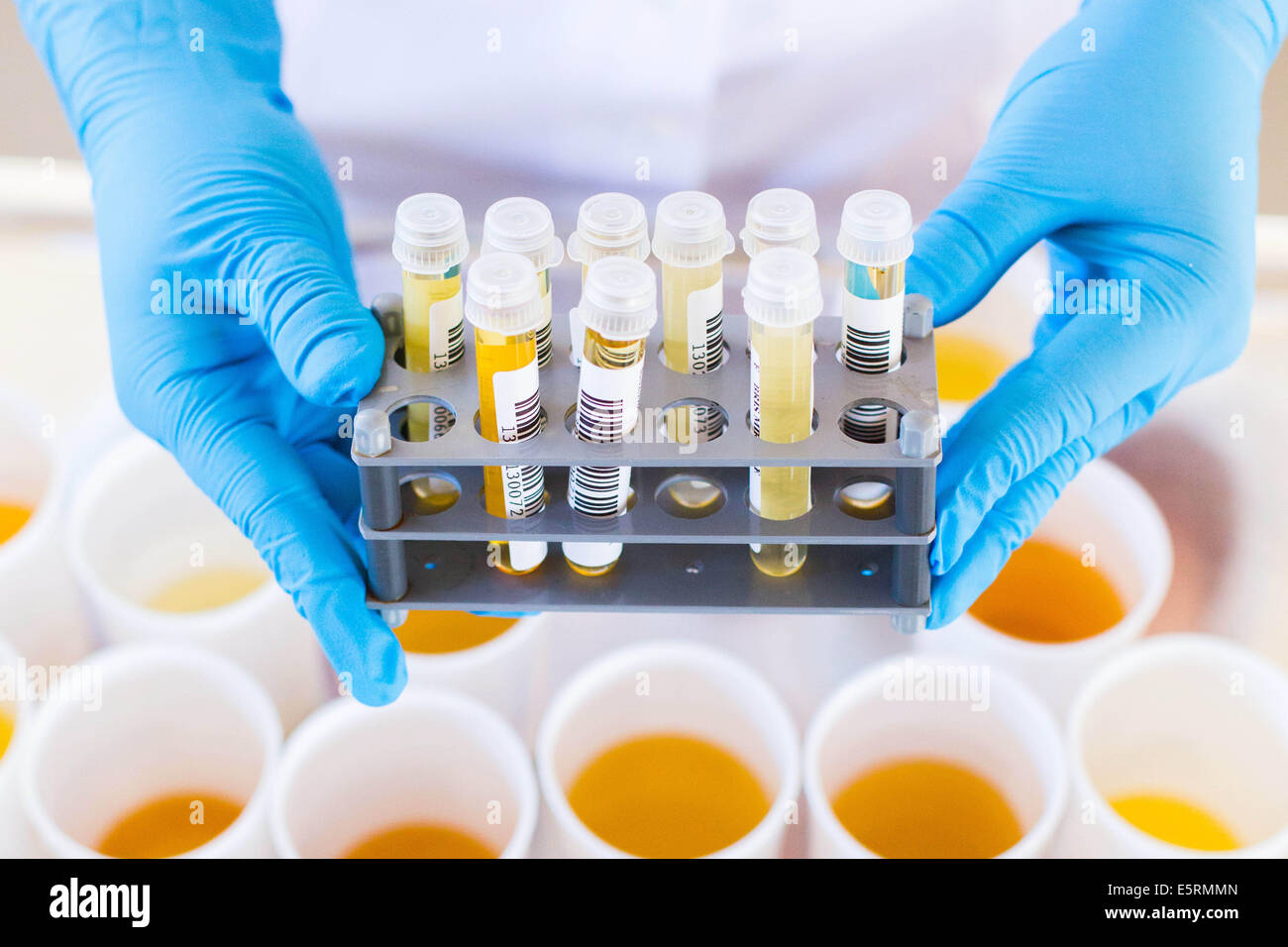Urine analysis in laboratory Stock Photo - Alamy